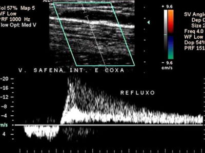 Manual de Doppler - Radiologia Online